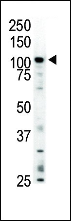 Anti MERTK（ABG-AP7662A-0.1MG）（カテゴリ：抗体関連） | 商品情報 | コスモ・バイオ株式会社