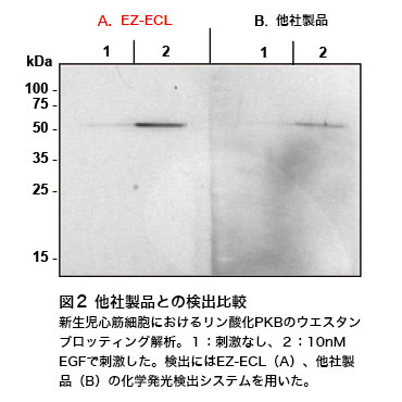 EZ-ECL Kit（BLG-20500120-1KIT[1200 cm2(for 12 mini blots)]）（カテゴリ：遺伝子工学） | 商品情報 | コスモ・バイオ株式会社