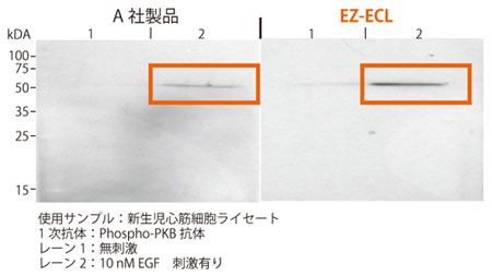 EZ-ECL Kit（BLG-20500120-1KIT[1200 cm2(for 12 mini blots)]）（カテゴリ：遺伝子工学） | 商品情報 | コスモ・バイオ株式会社