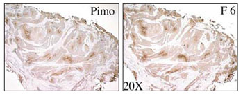 Hypoxyprobe-Gemini Kit（HPI-HP5200-1KIT[200mg pimonidazole HCL and ...
